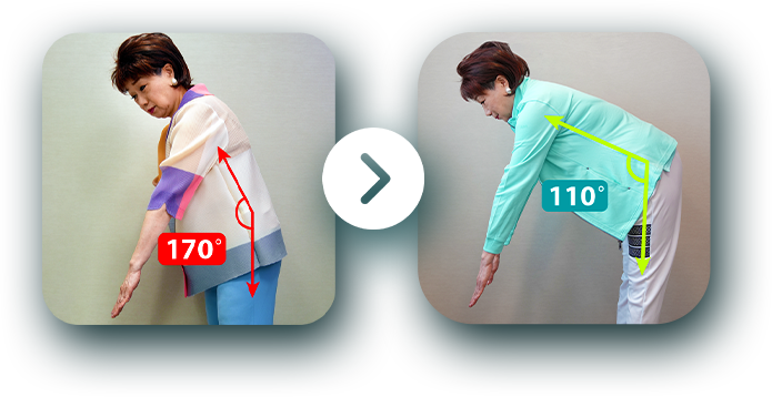 Spine MT 3D | NYMG New York Musculoskeletal Group 紐約肌肉骨骼集團 | 熱線: (852 ...